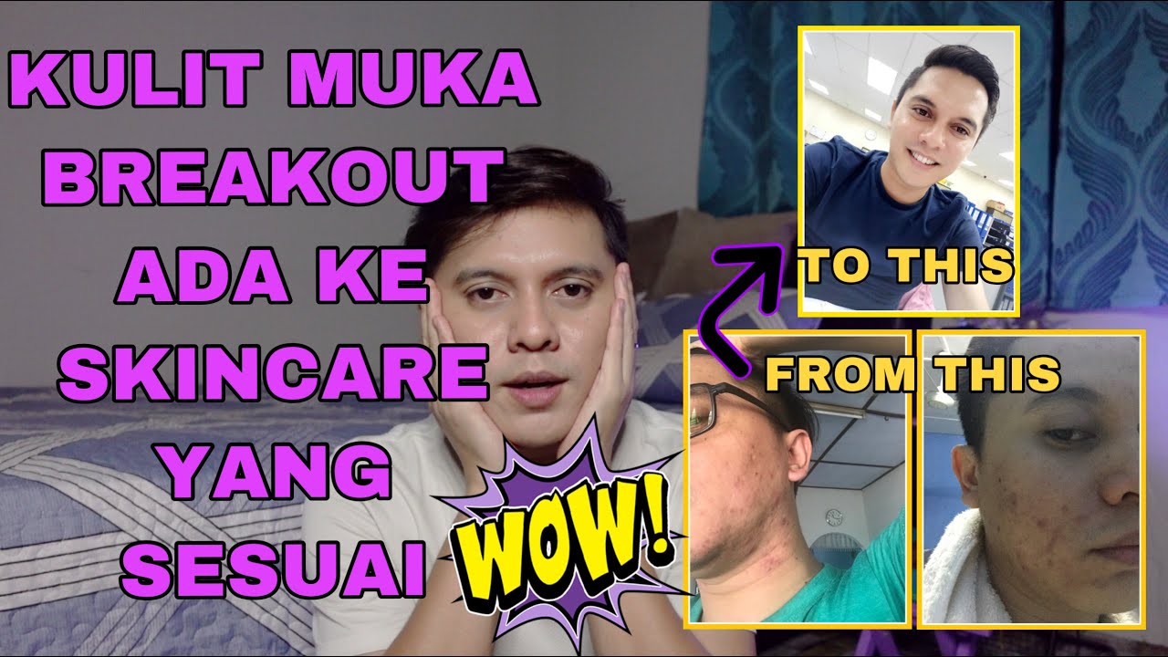 KULIT MUKA BREAKOUT?? | APA SKINCARE YANG SESUAI? | MY - YouTube
