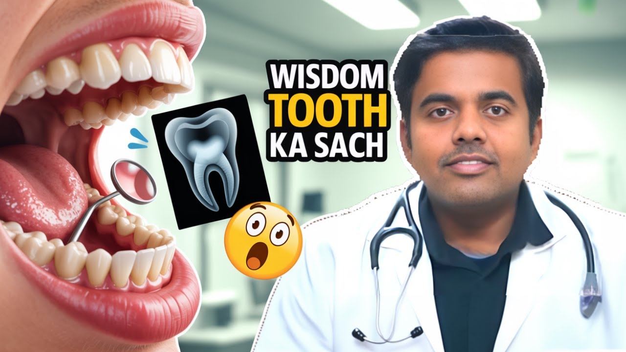 What REALLY Happens When Wisdom Teeth Grow In - YouTube