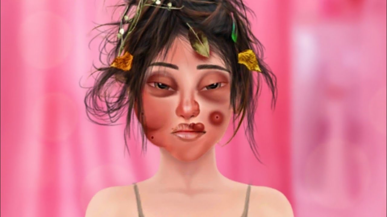 ASMR Animation video|ugly skin treatment |ASMR makeover doctor ...