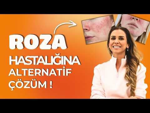 Roza Hastalığına Karşı En Etkili Bakım