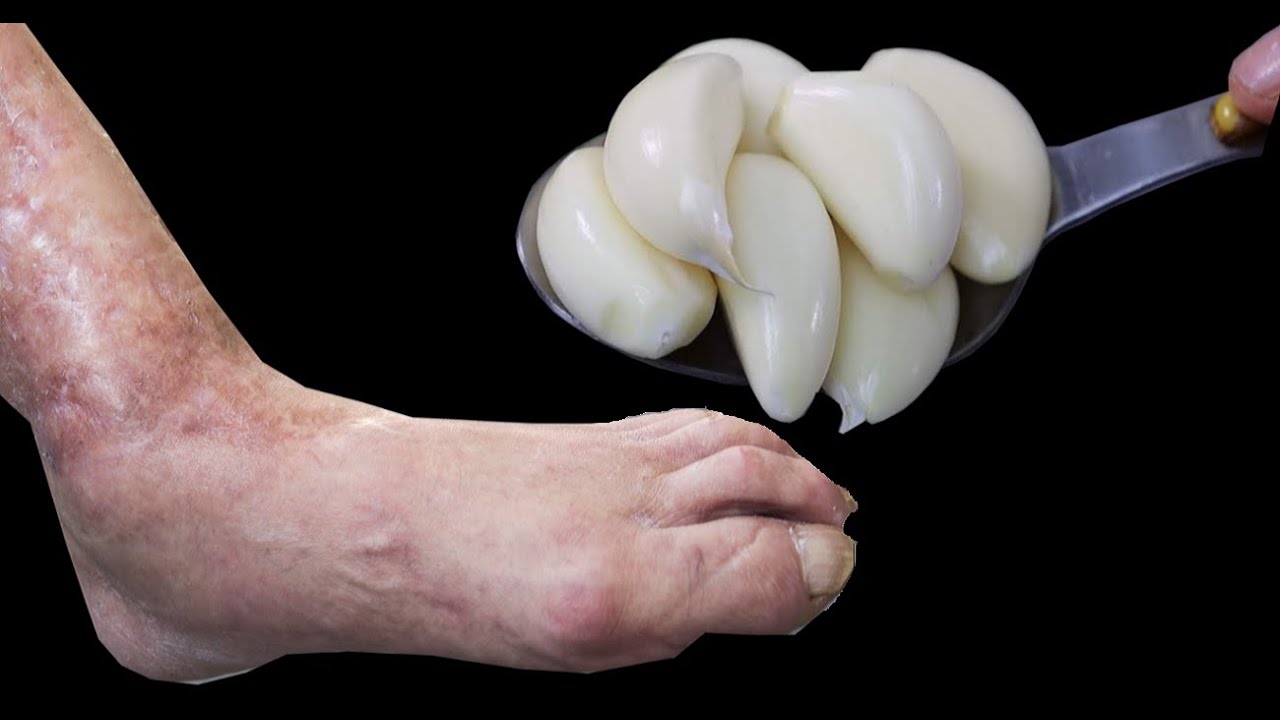 Leg pain, rheumatism, varicose veins, arthritis, headache, joint pain ...