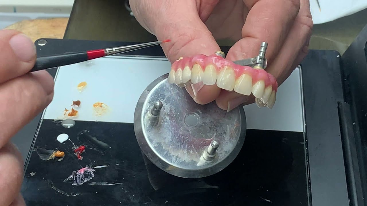 Toronto in composito / Parte 5: Lucidatura e rifinitura protesi in ...