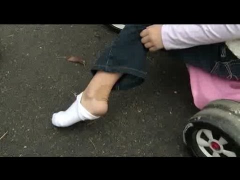 Potentially rabid fox bites three children in Westfield - YouTube