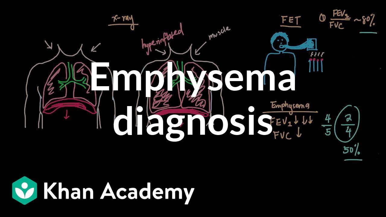 Emphysema diagnosis | Respiratory system diseases | NCLEX-RN | Khan ...