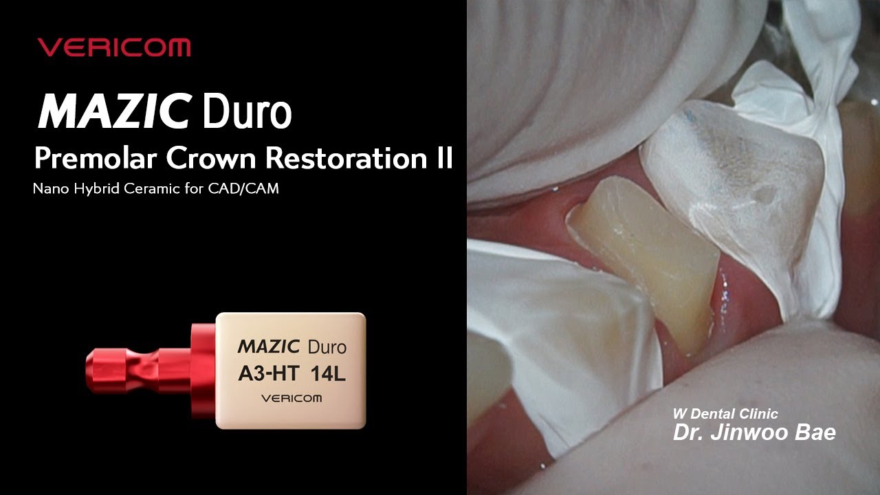 MAZIC Duro Premolar Crown Restoration II - YouTube