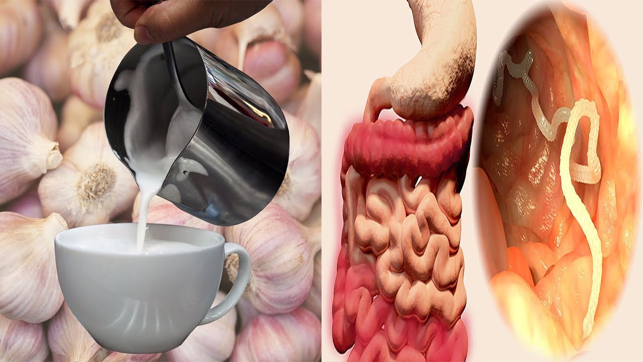 Krimbat e zorrëve. Kjo është receta 100% natyrale që do t'i largojë një ...