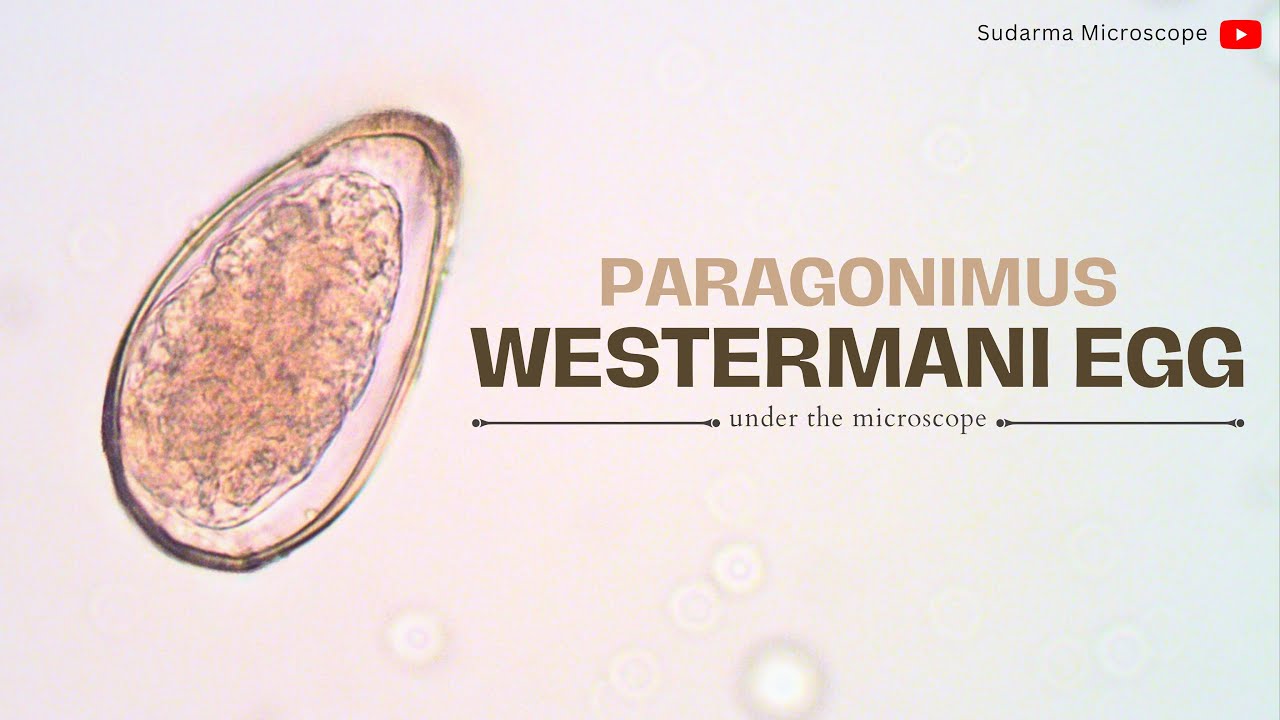 Paragonimus westermani egg under the microscope - YouTube
