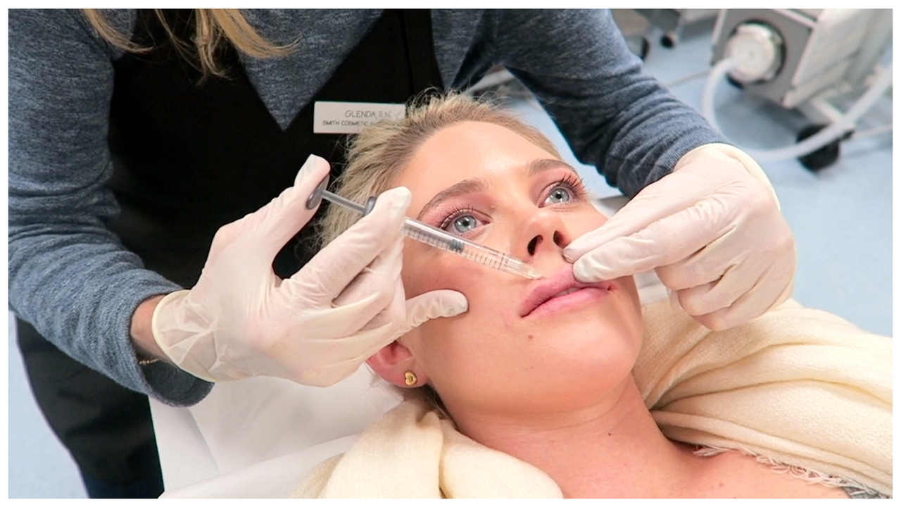 GETTING INJECTIONS! | JUVEDERM - YouTube