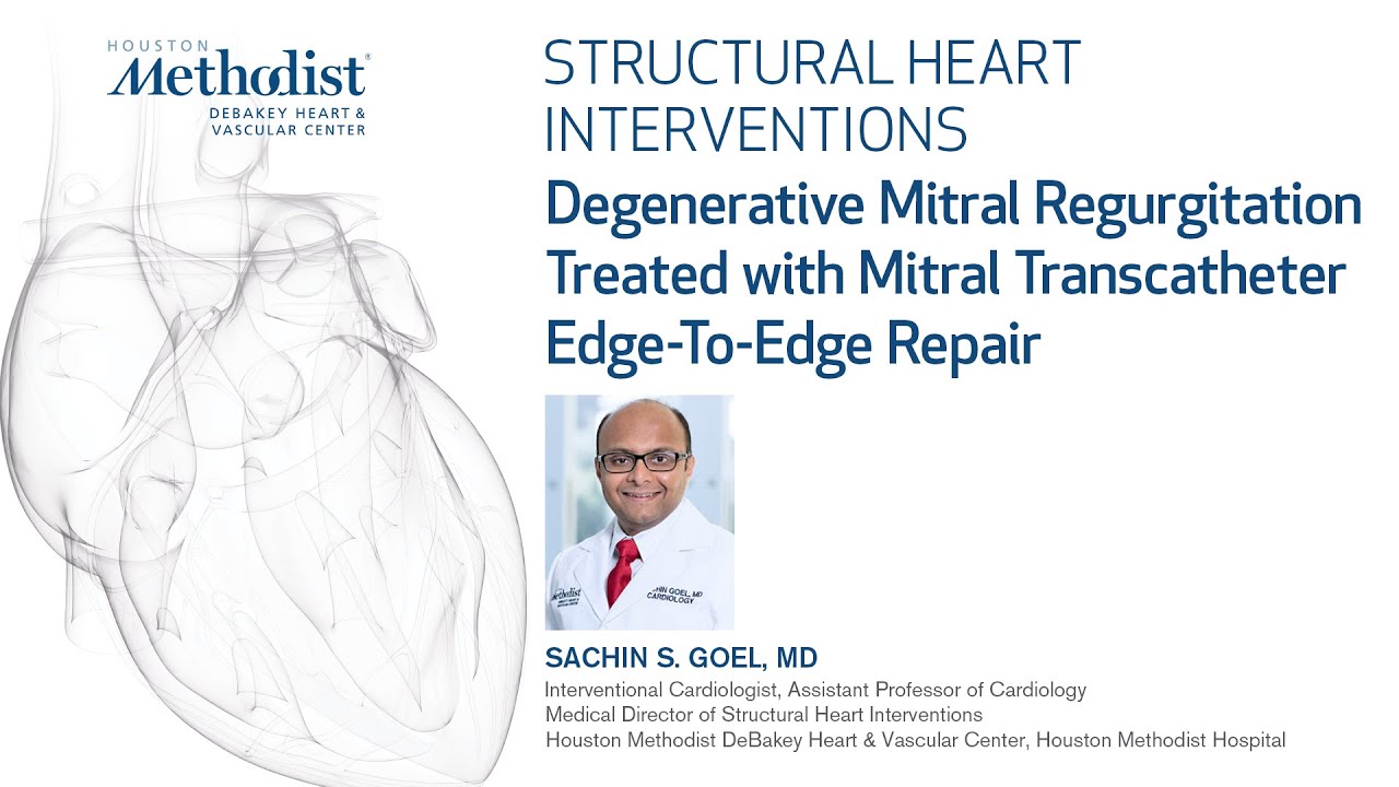 Structural Heart Intervention Series: Degenerative MR treated with ...