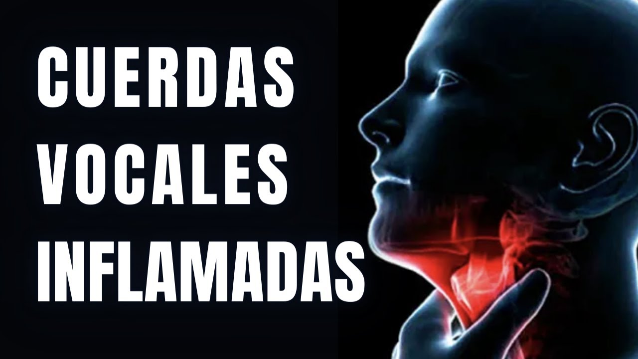 ¿COMO saber si tengo las cuerdas vocales INFLAMADAS? 😱 - Haz este ...