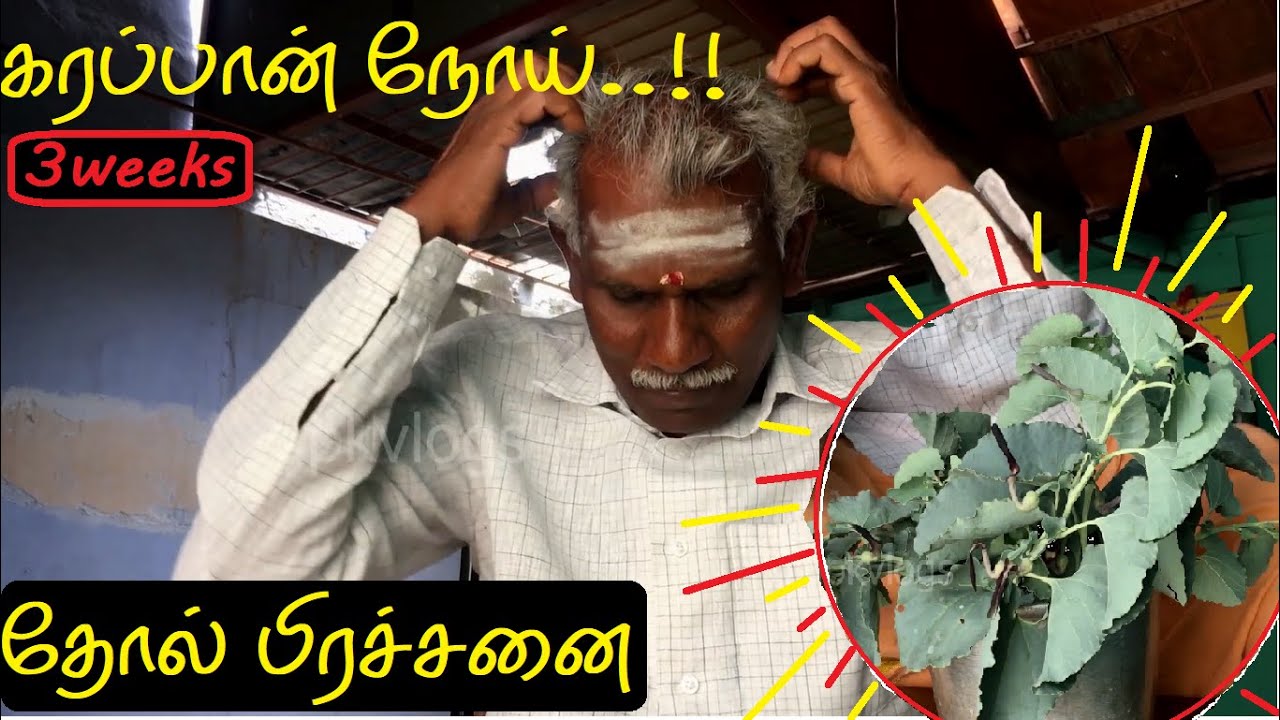 கரப்பான் நோய் | Karappan | Itching | தோல் பிரச்சனை problem | (Aadu ...