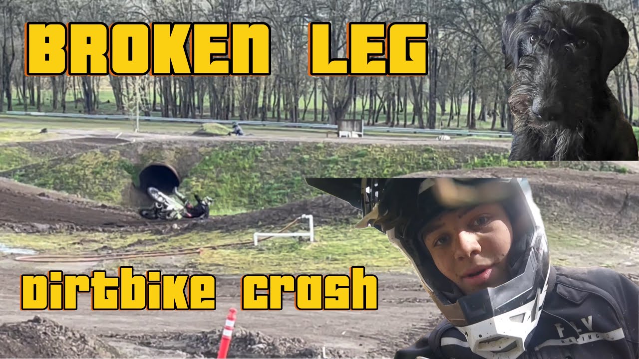 BROKEN LEG, First Motocross Race | w/ Tanner & Cole - YouTube