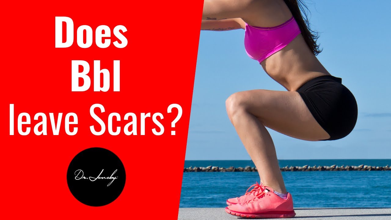 Can I get rid of Cellulite with a BBL ? | Dr Jeneby BBL Procedure ...