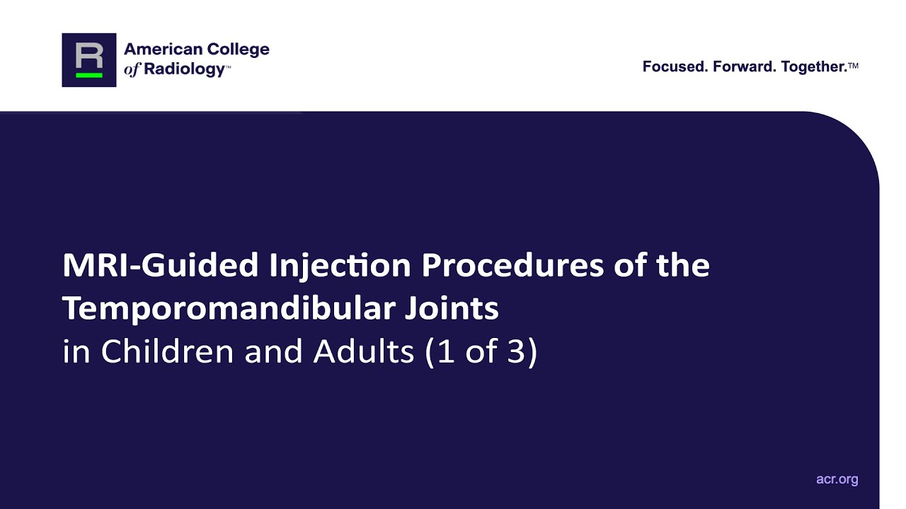 MRI-Guided Injection Procedures of the Temporomandibular Joints in ...