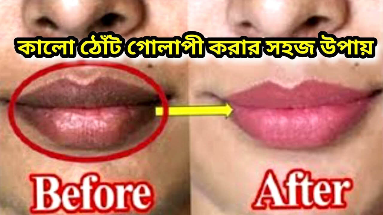 Easy way to remove lip black spots in the domestic system!!! - YouTube