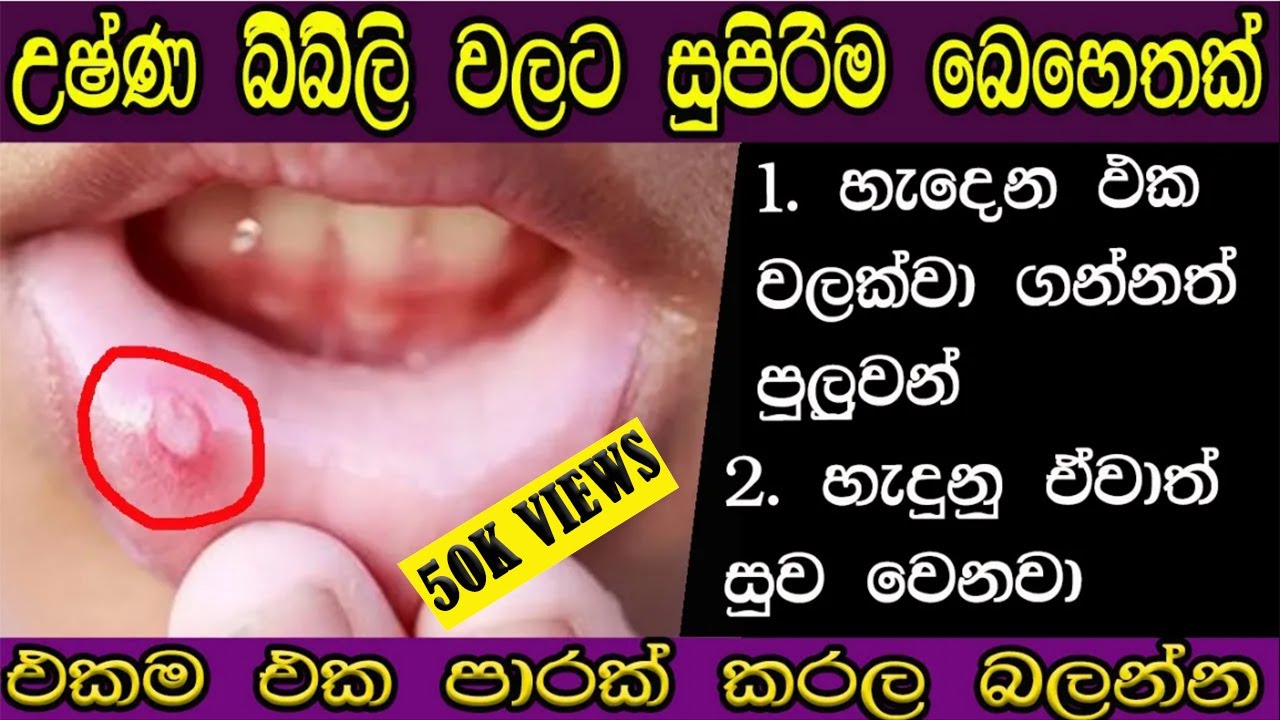 කටේ තුවාල වලට බෙහෙත් | kate thuwala walata ath beheth | ushna bibili ...