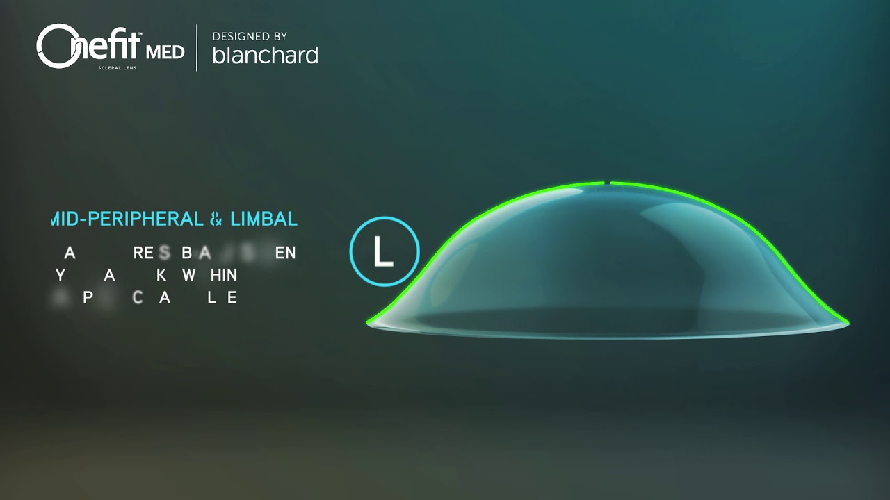 Onefit MED Scleral Lens - YouTube
