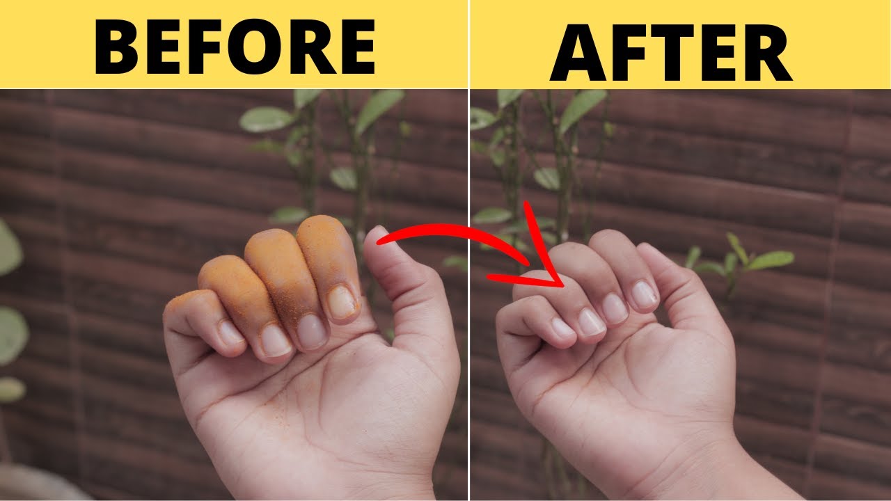 How to Remove Turmeric Stains from Hands & Nails DIY - YouTube