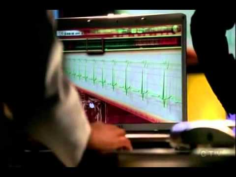 pacemaker, home monitoring pacemaker therapy - Biotronik in CSI MIAMI ...