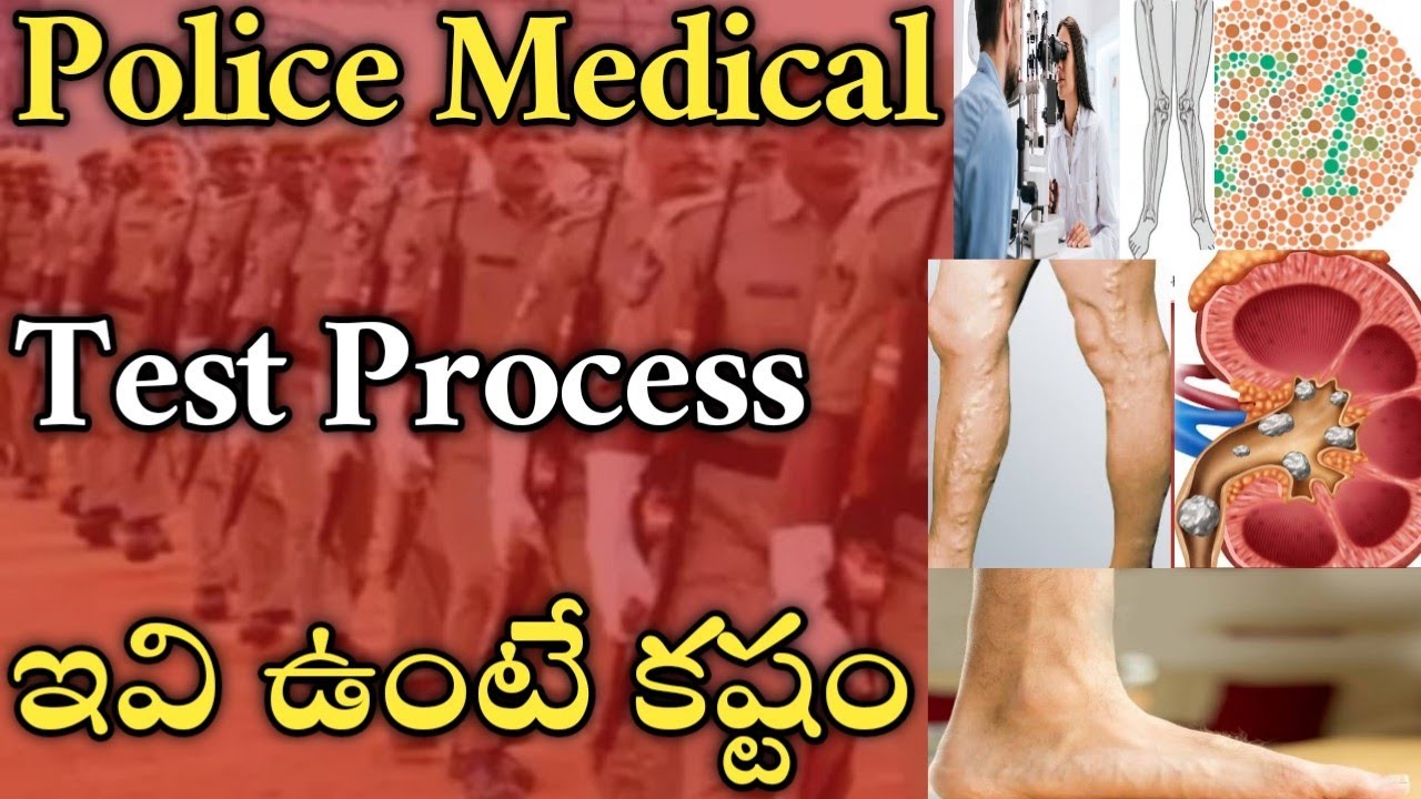 Police Medical Test Process 2023 || Constable Medical Process || SI ...