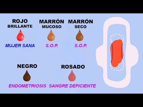 Colores de la menstruación ¿SOP endometriosis? #sop #menstruation # ...