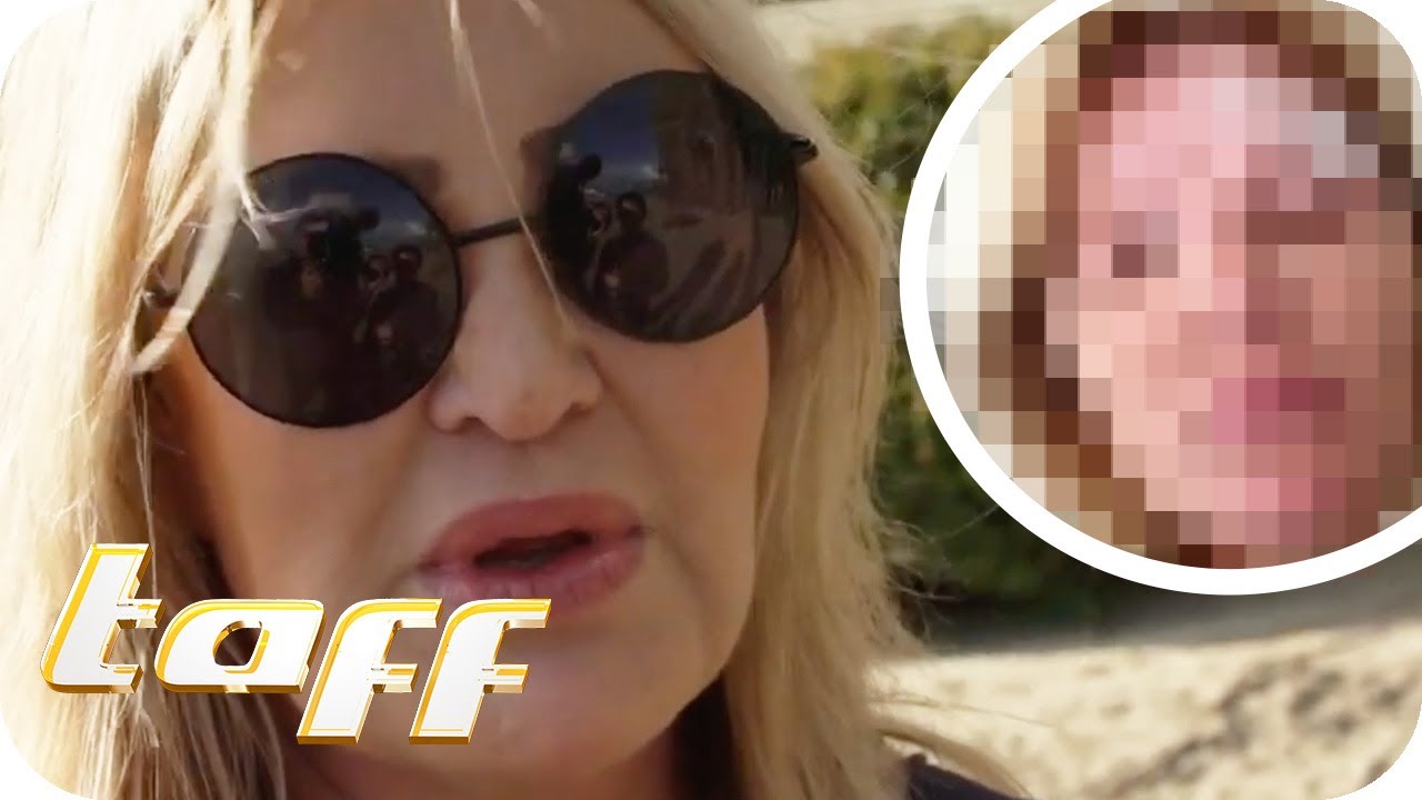 Horror-Beauty-Eingriff! Nach Ärztepfusch brauchte Carol ein neues ...