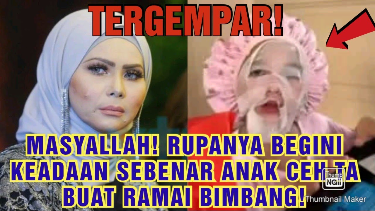 Akibat kerap Bersolek, Lihat Wajah Anak Ceh ta buat ramai terkejut! Di ...