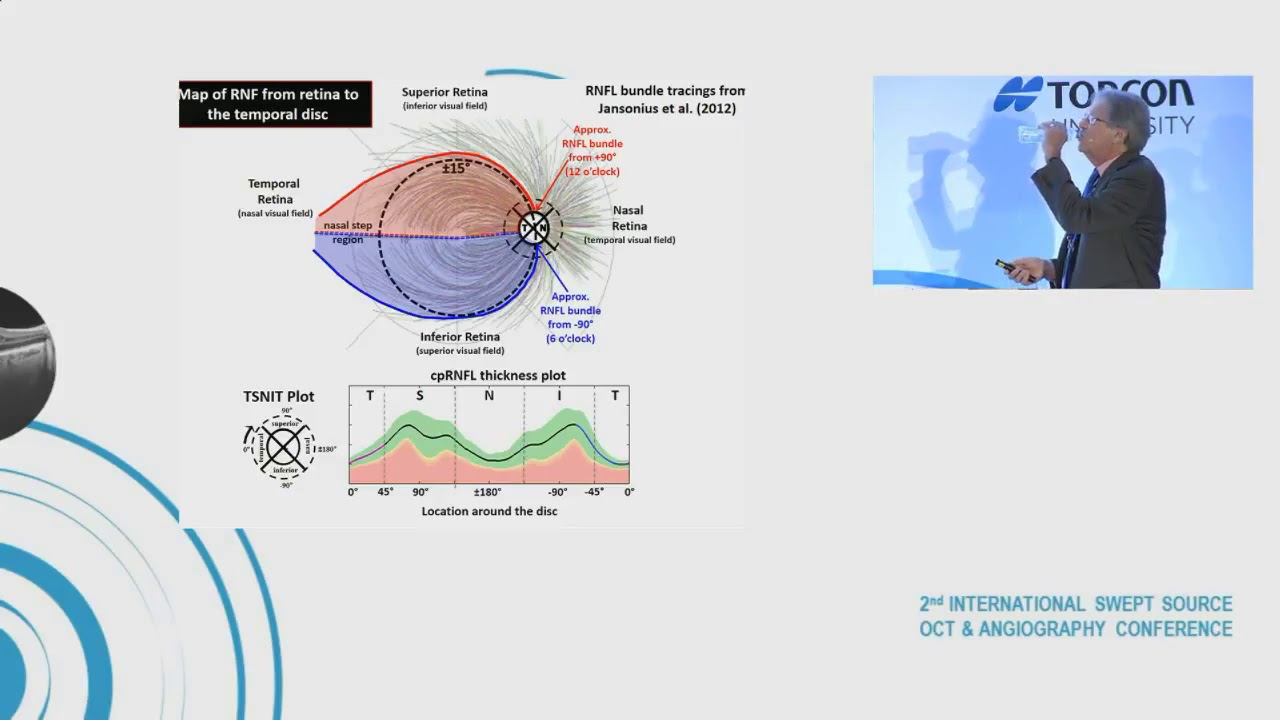 Prof Donald C.Hood, PhD, Diagnosing & understanding glaucomatous damage ...