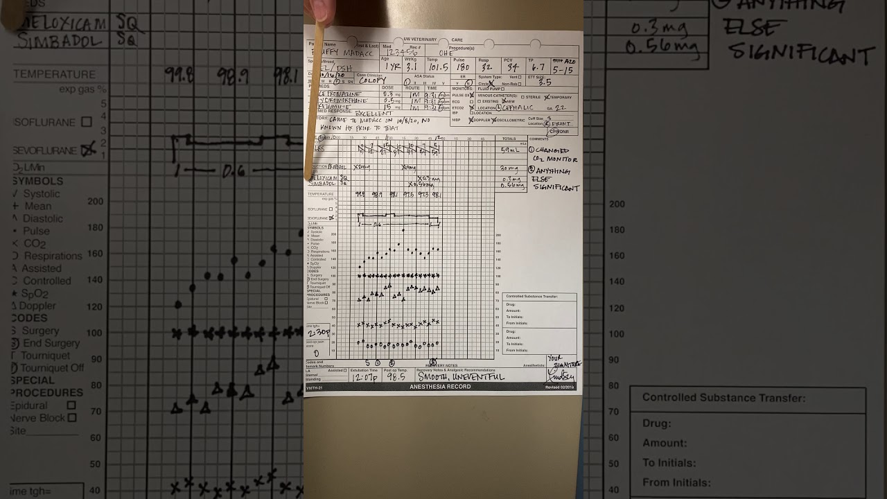 Anesthesia record - YouTube