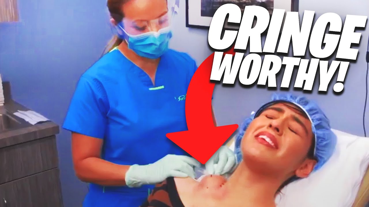 The Most CRINGE WORTHY Cysts and Pimple Pops On Dr. Pimple Popper ...