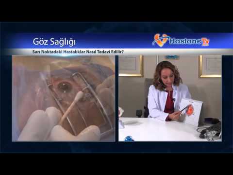 Sarı Noktadaki Hastalıklar Nasıl Tedavi Edilir?