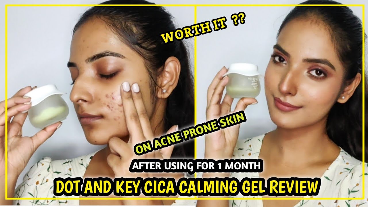 Dot And Key Cica Calming Gel Review On Acne Prone Skin Best dot-and-key-cica-calming-gel-review-on-acne-prone-skin-best