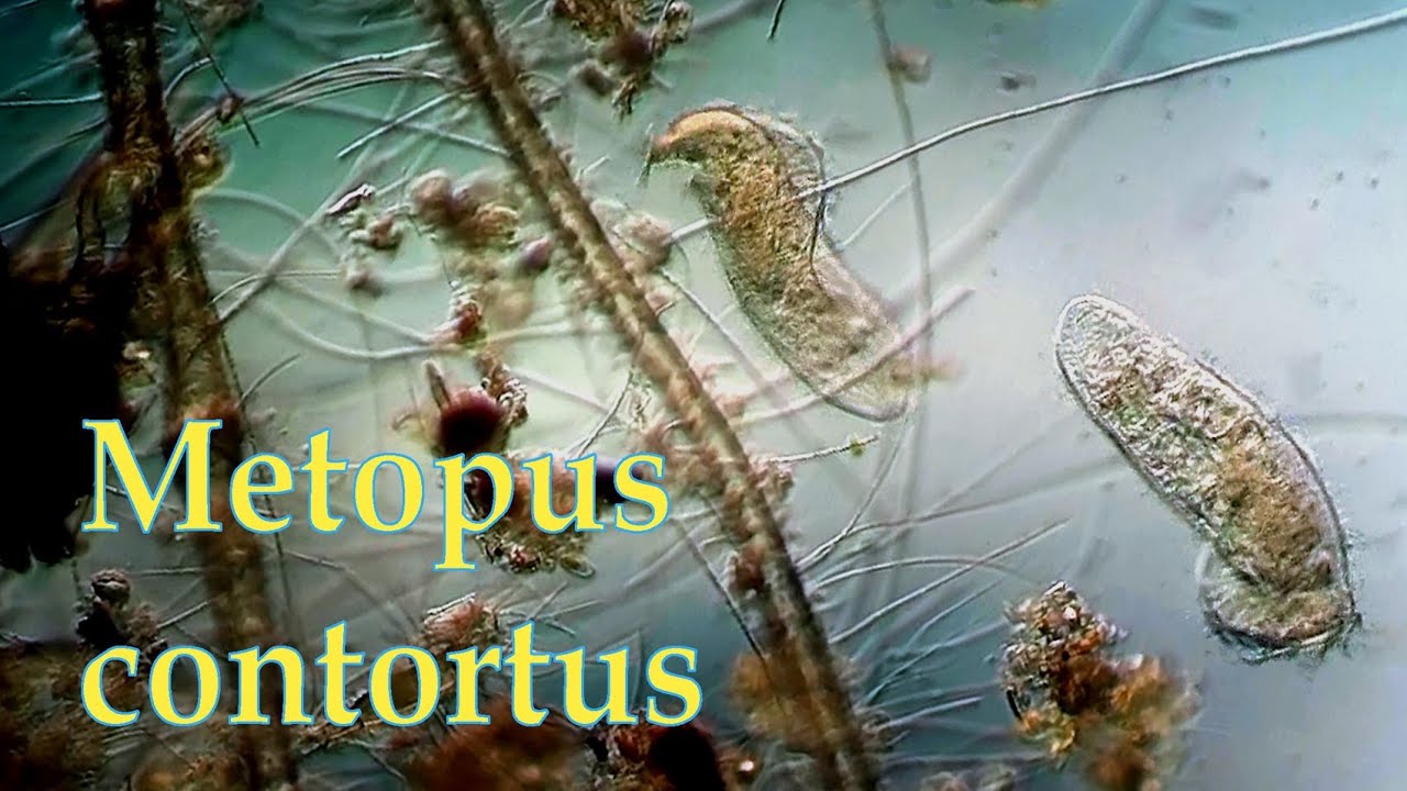 Metopus contortus - YouTube