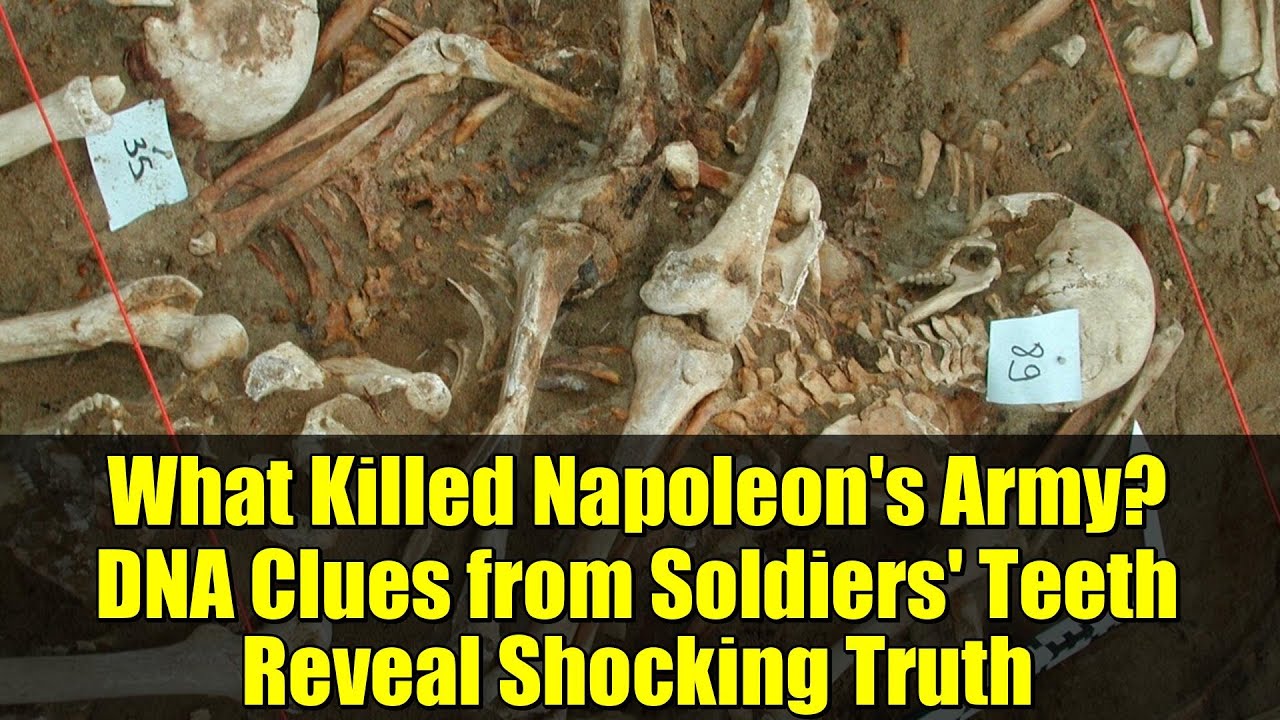 What Killed Napoleon's Army? DNA Clues from Soldiers' Teeth Reveal ...