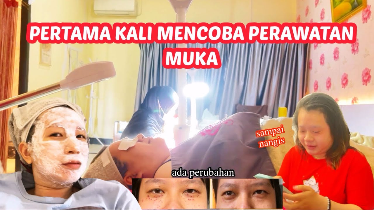 SAMPAI KAPOK PERAWATAN MUKA, SAKIT BANGET INI… #58 - YouTube