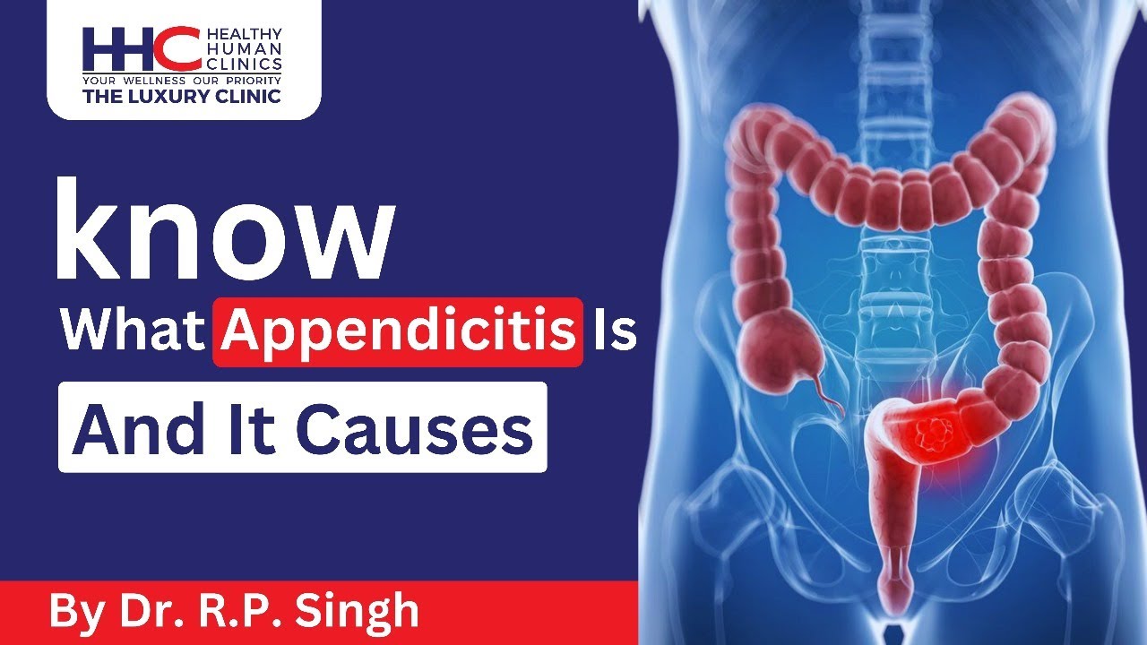 Appendix: What Are Symptoms of Appendicitis? | Appendicitis Treatment (In Hindi) | Dr. R.P Singh ...