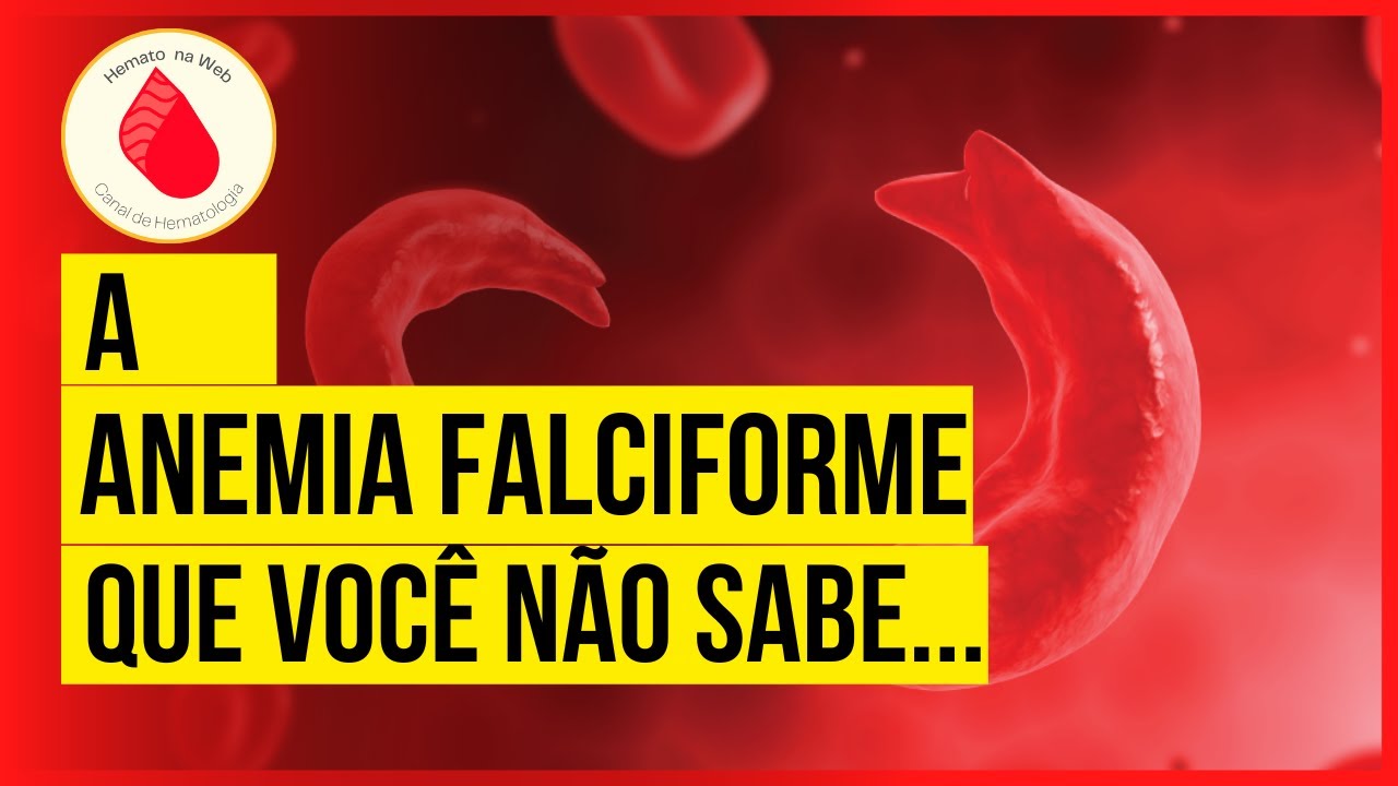 A ANEMIA FALCIFORME e suas COMPLICAÇÕES! Saiba mais! | Geydson Cruz; MD ...