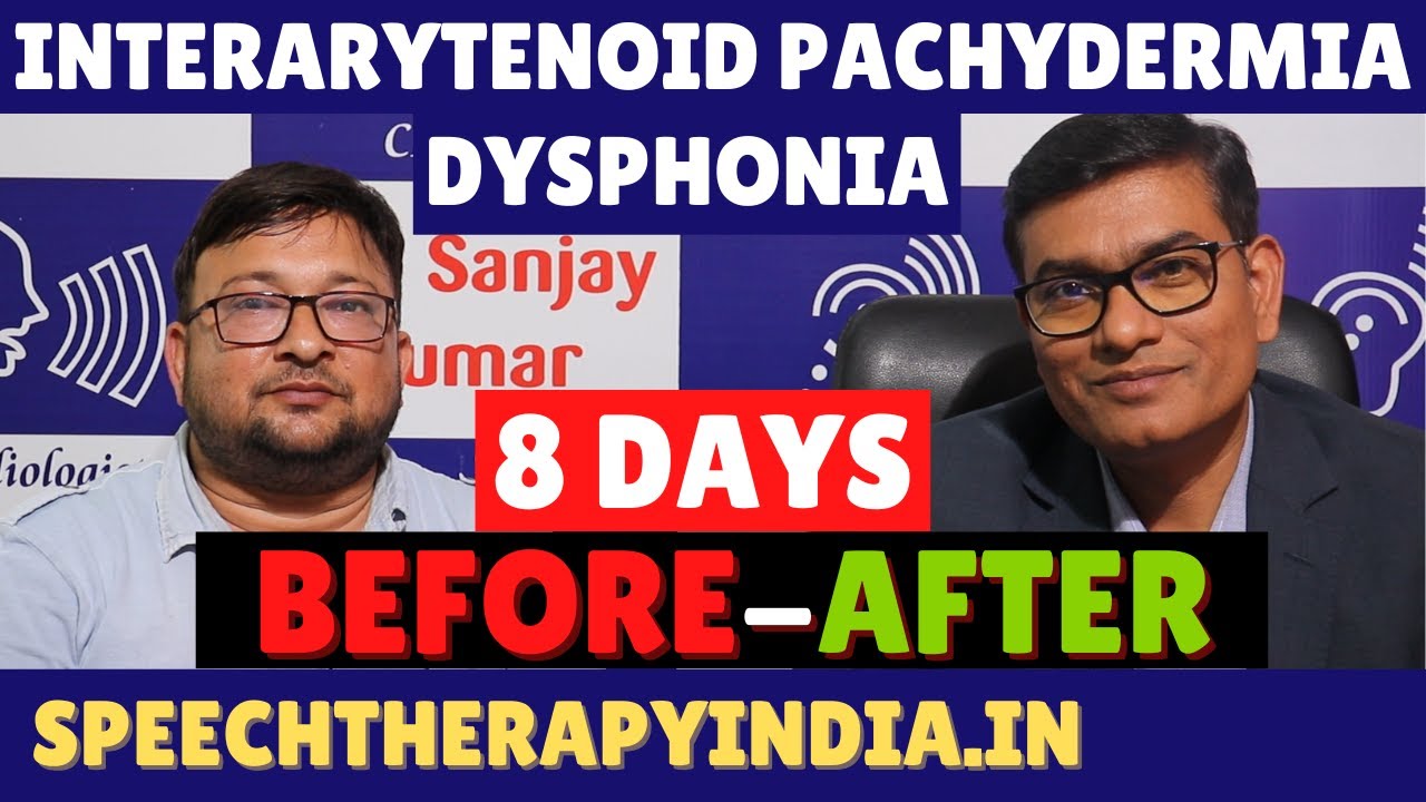 Before-After Dysphonia | Interarytenoid Pachydermia, Soft Voice ...