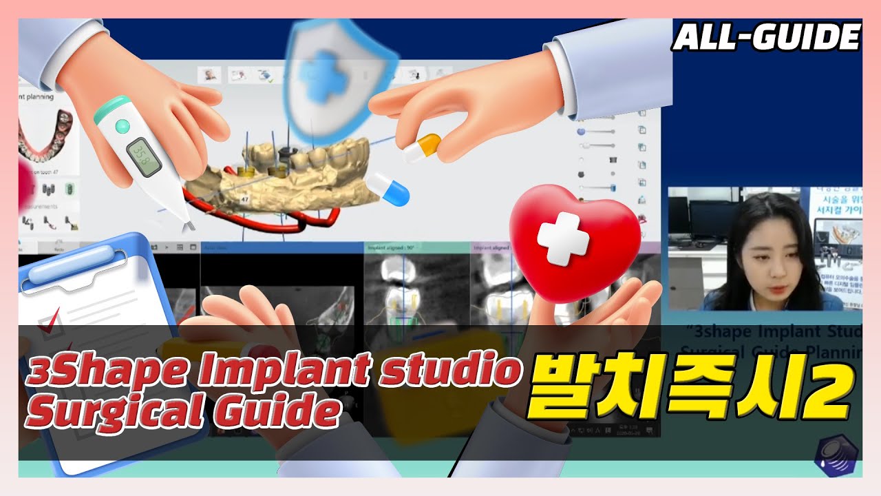 3Shape Implant studio Surgical Guide 5 - 발치즉시 2 - YouTube
