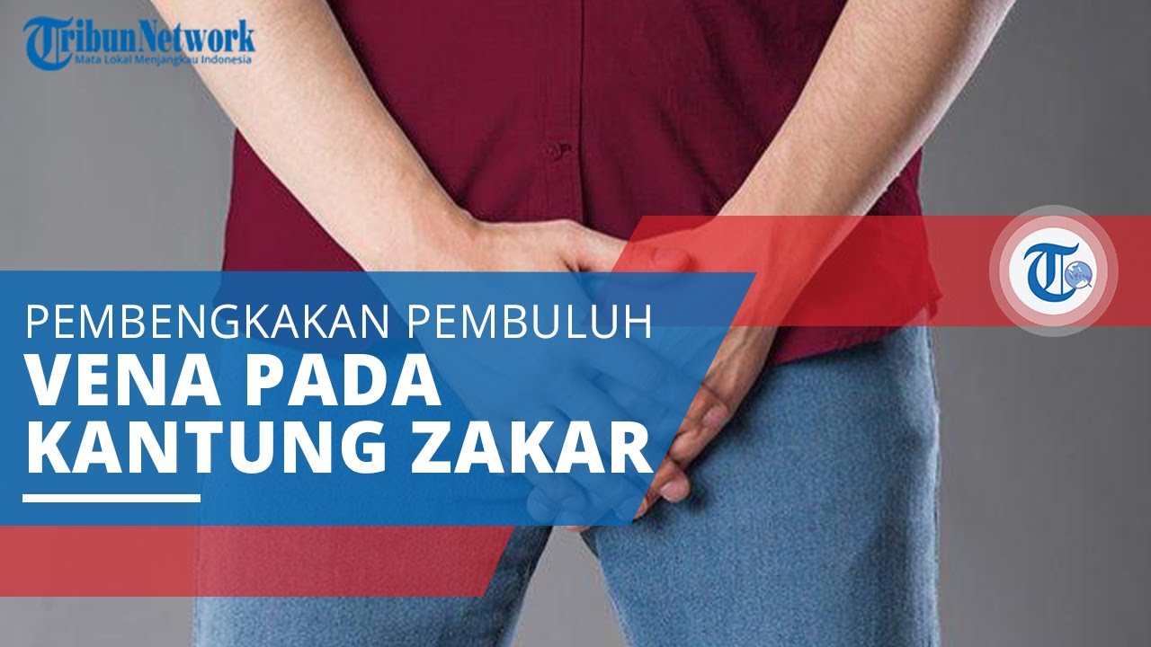 Varikokel, Pembengkakan Pembuluh Darah Vena yang Terjadi di Dalam ...