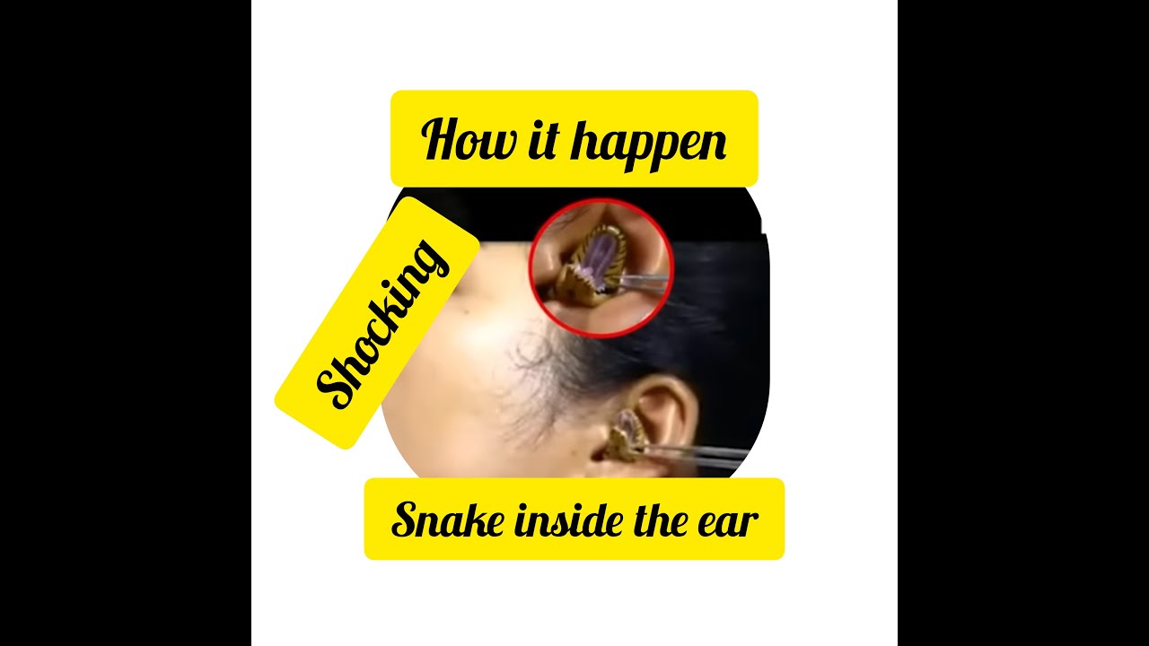 BABAENG MAY AHAS SA TENGA snake inside the ear #rontheadventurervlog # ...