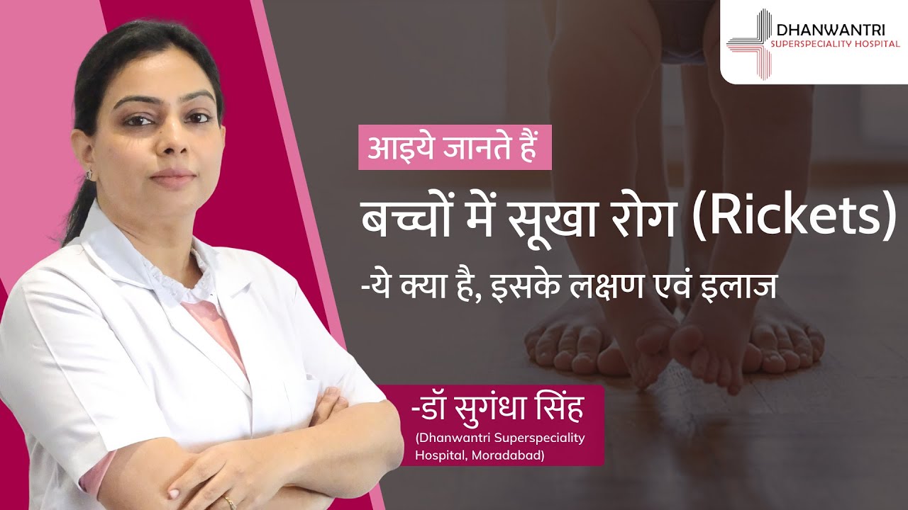 बच्चों में सूखा रोग के कारण, लक्षण एवं इलाज | Rickets In Children- It's ...