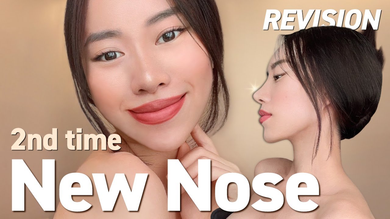 MY NEW NOSE REBORN at NANA hospital/korea plastic surgery - YouTube