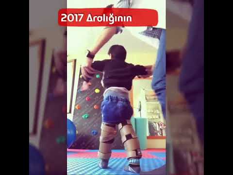 Fizyoterapi Gelişim Öyküsü/Burak kayra