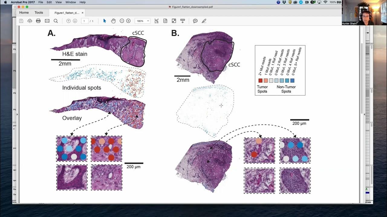 Calling Point Mutation from 10x spatial transcriptomics data - YouTube