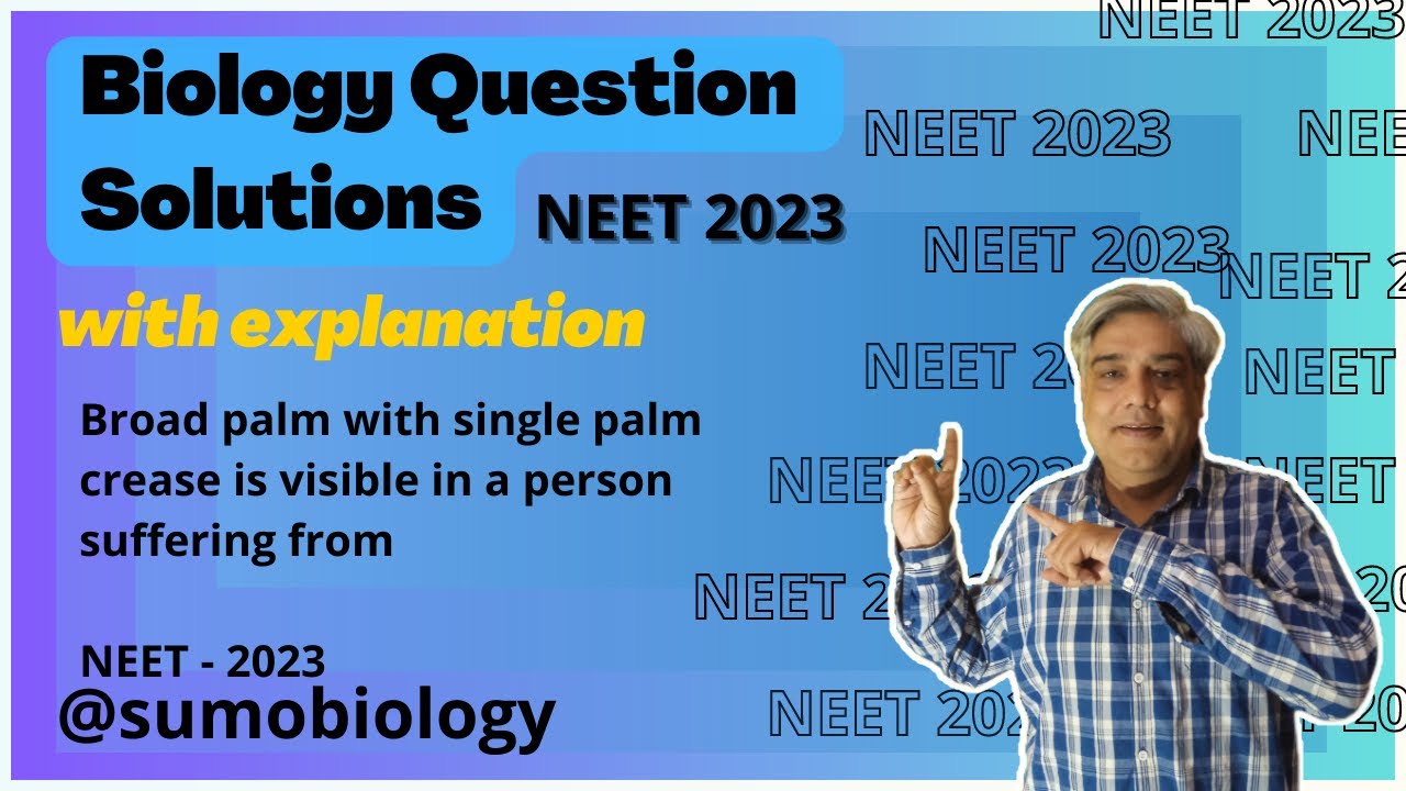 Broad palm with single palm crease is visible in a person suffering ...