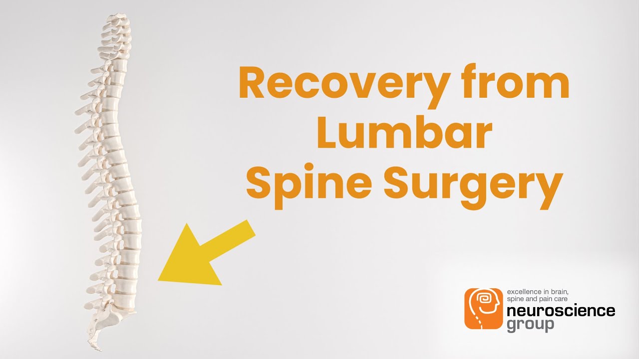 What to Expect After Your Lumbar Spine Surgery - YouTube