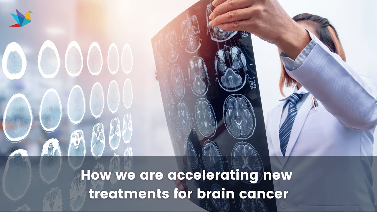 How we are accelerating new treatments for brain cancer - YouTube