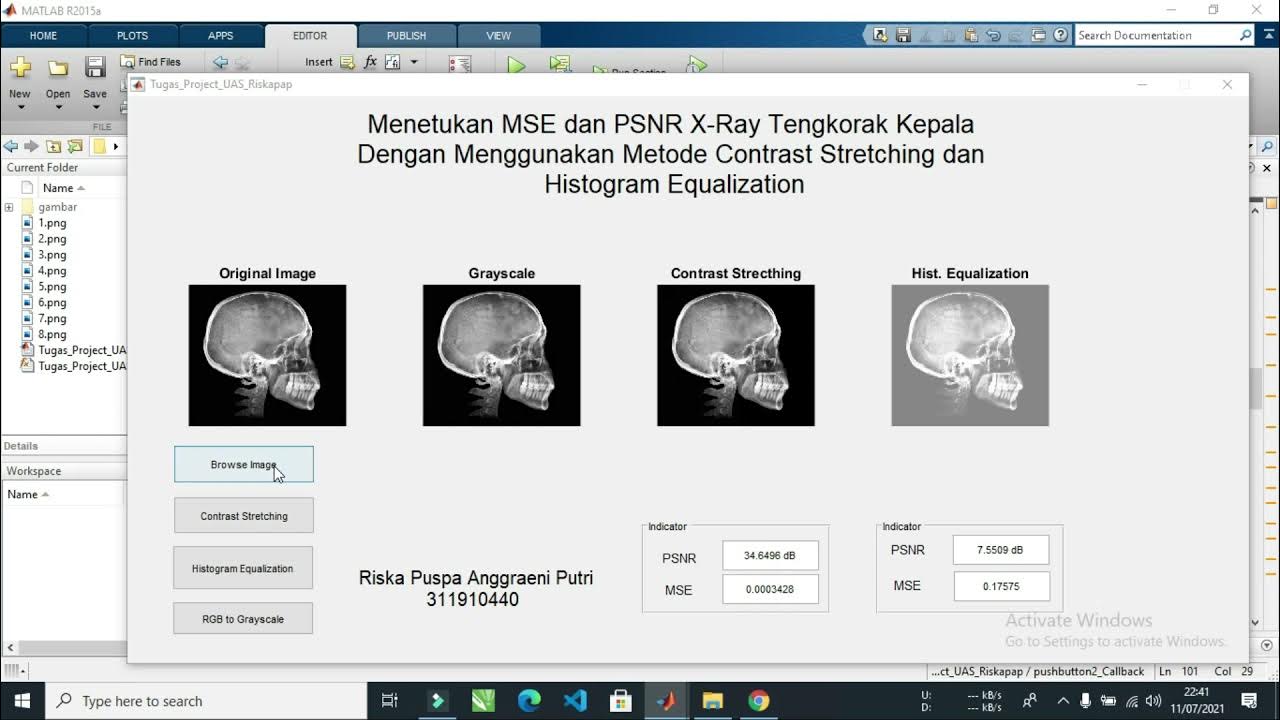 cara menentukan MSE dan PSNR X-RAY Tengkorak Kepala - YouTube