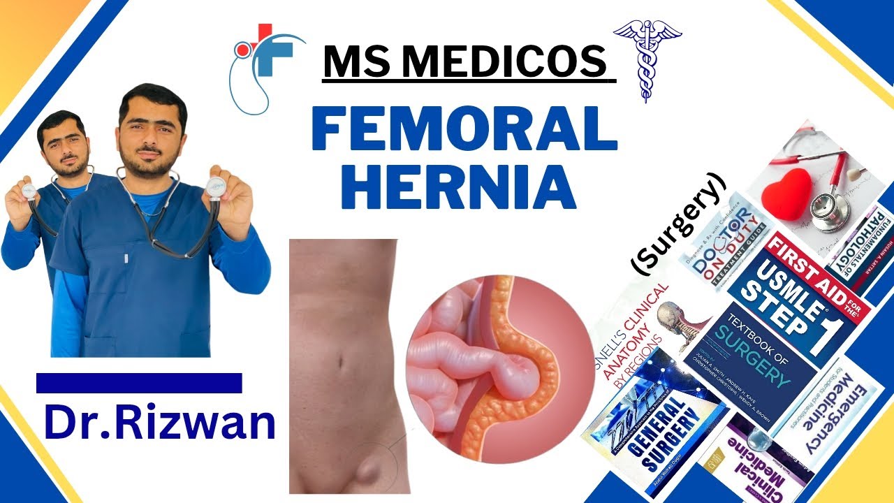 Femoral Hernia | Anatomy, Causes, Symptoms & Surgical Management ...